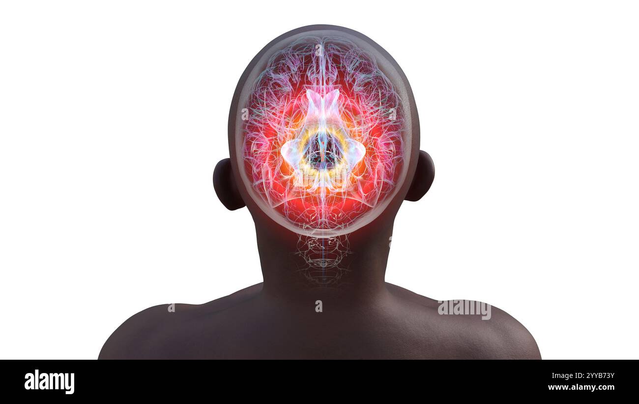 Computer illustration of the human brain with the cerebral aqueduct ...