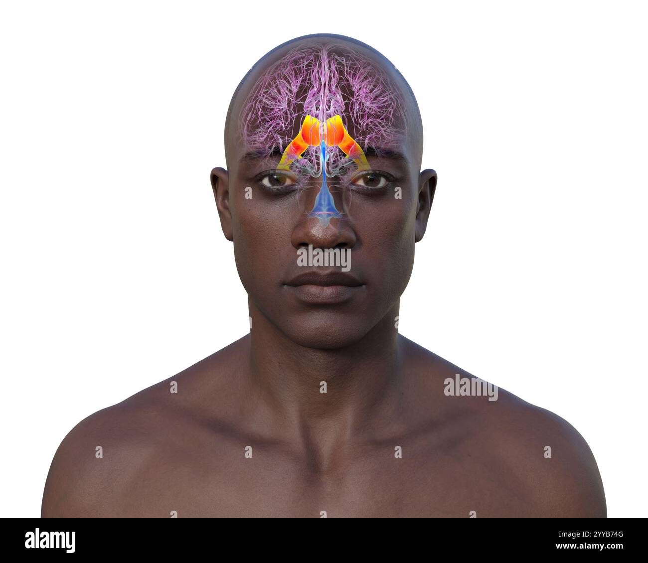 Computer illustration of the lateral brain ventricles, the largest ...