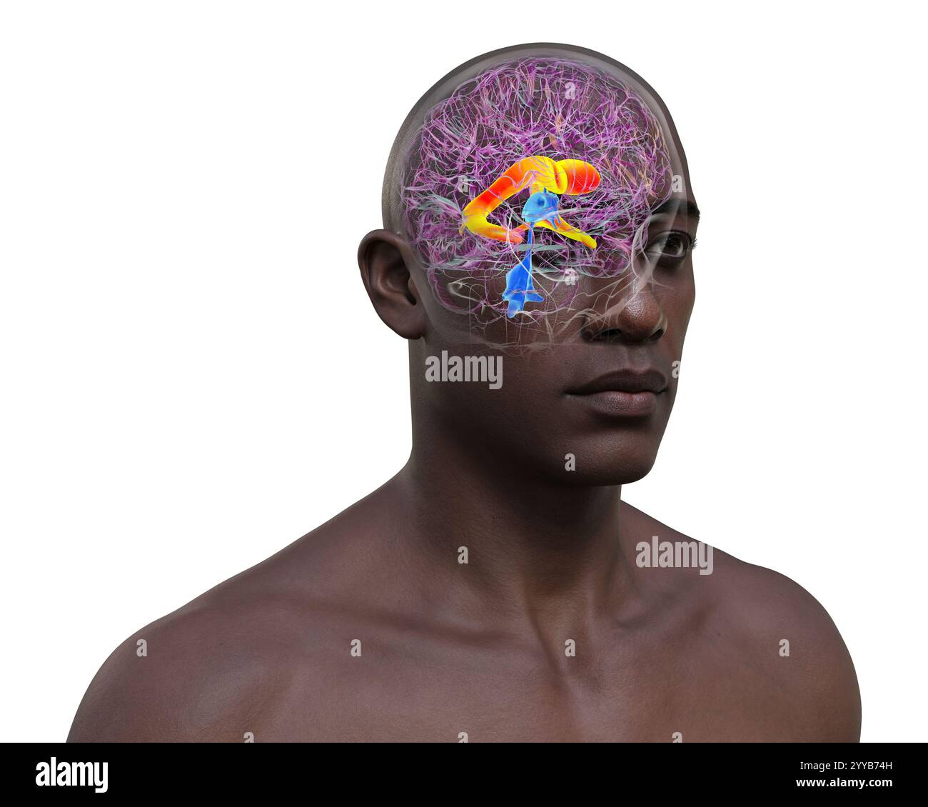 Computer illustration of the lateral brain ventricles, the largest ...