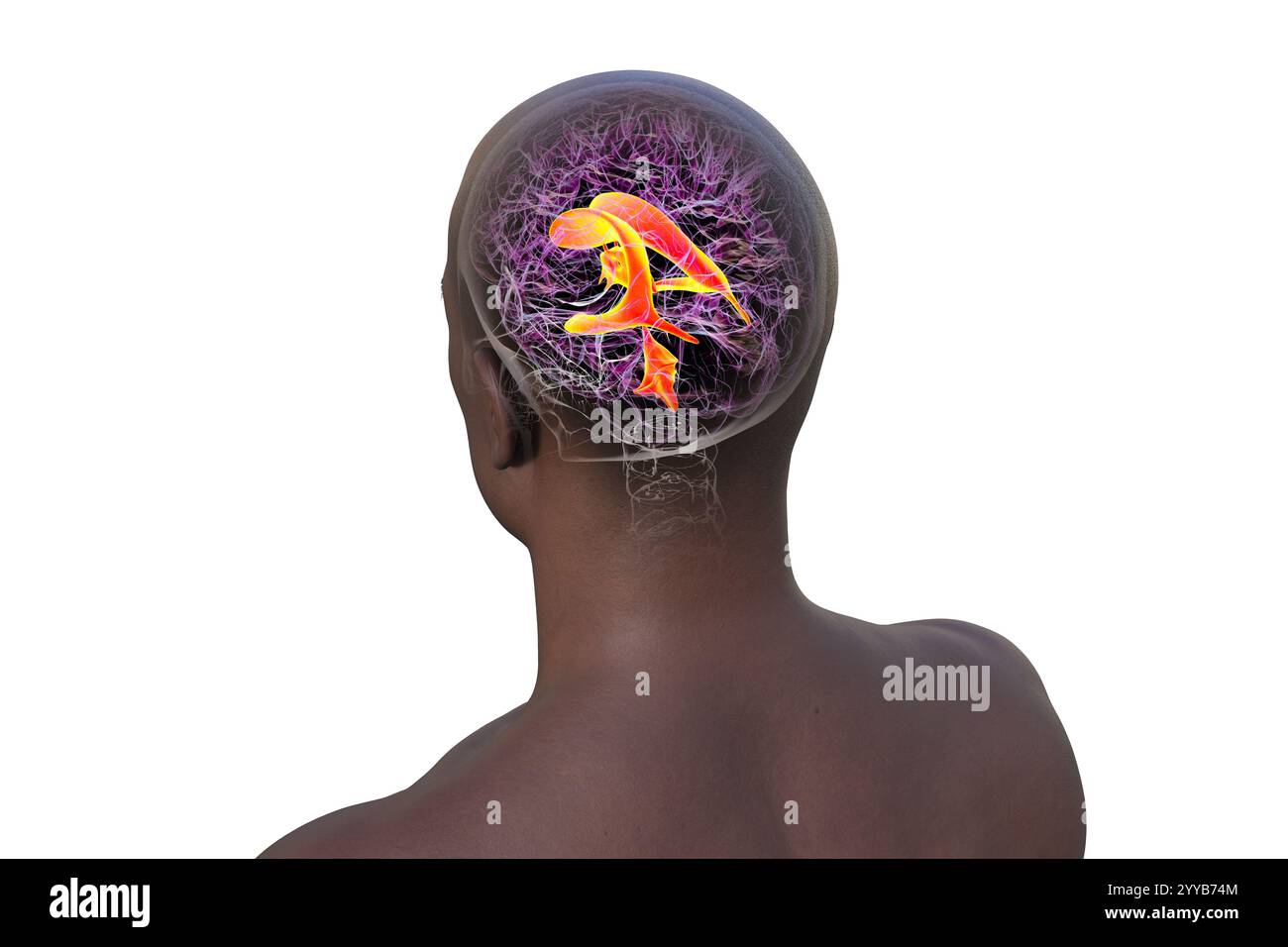 Ventricular system of the brain, computer illustration. The ventricles ...