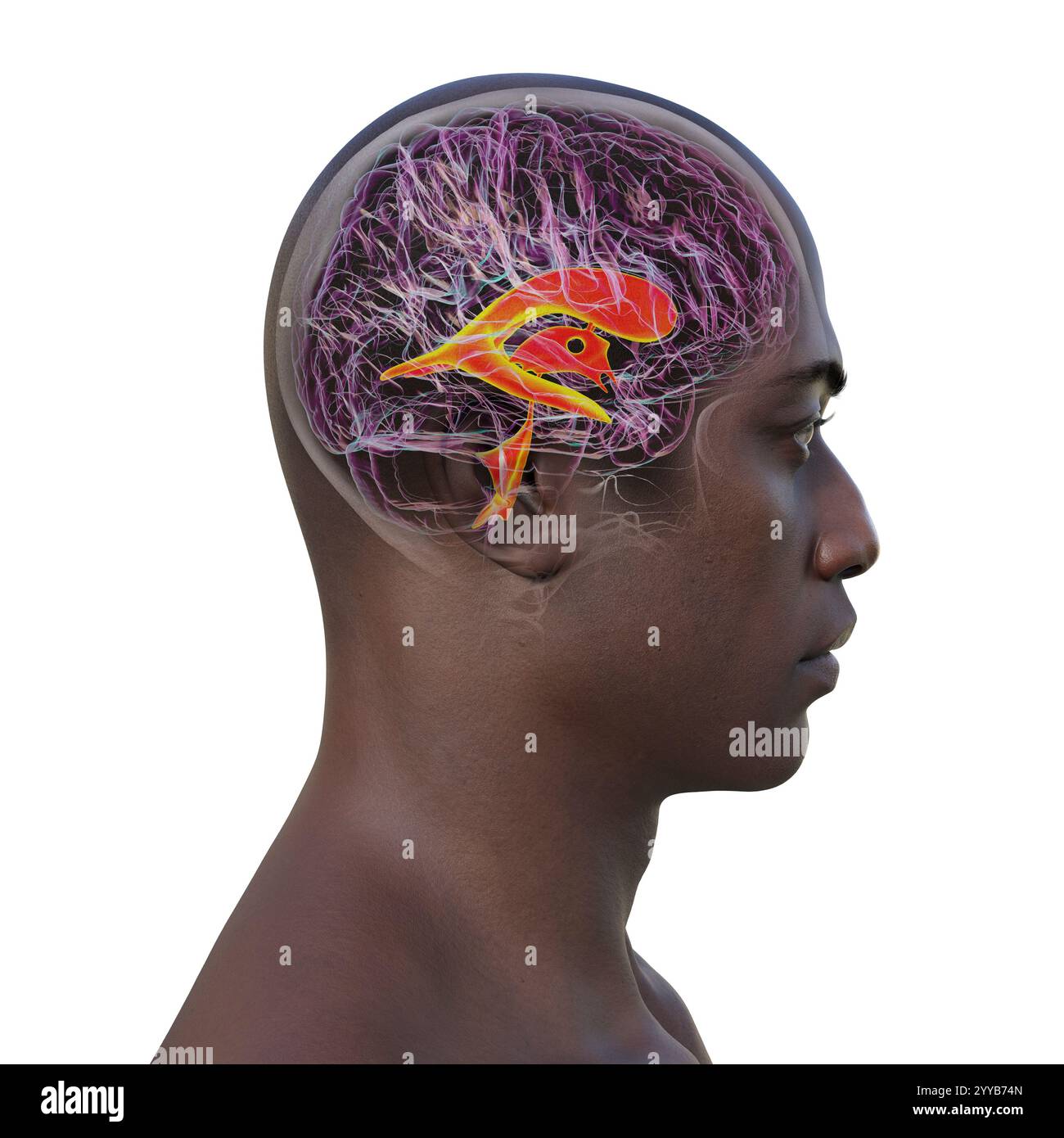 Ventricular system of the brain, computer illustration. The ventricles ...