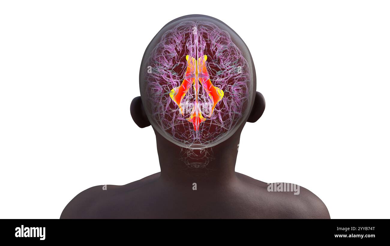 Ventricular system of the brain, computer illustration. The ventricles ...
