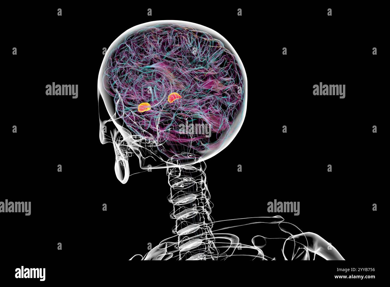 Human brain with the amygdala highlighted, computer illustration Stock ...