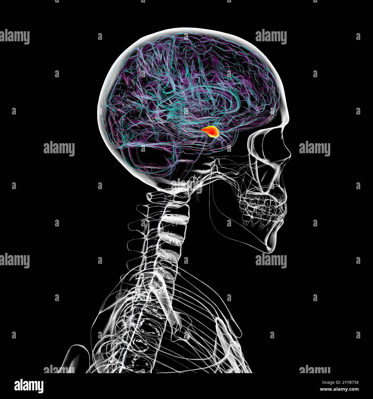 Human brain with the amygdala highlighted, computer illustration Stock ...