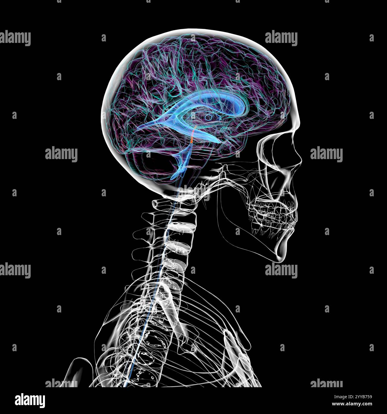 Fourth ventricle and cerebral aqueduct hi-res stock photography and ...