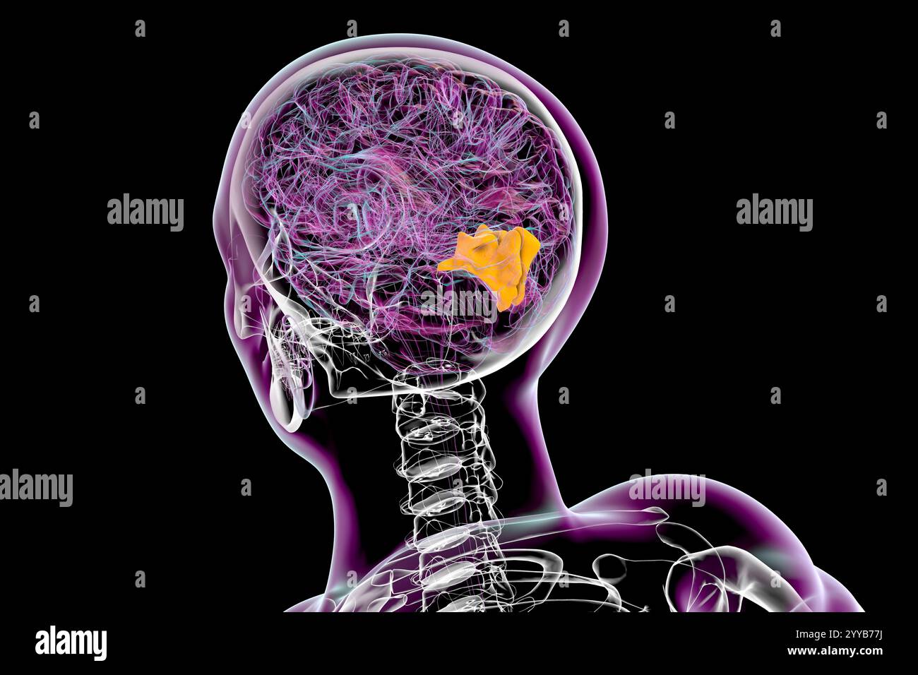 Computer illustration of the human brain highlighting the cuneus gyrus, which is responsible for ...