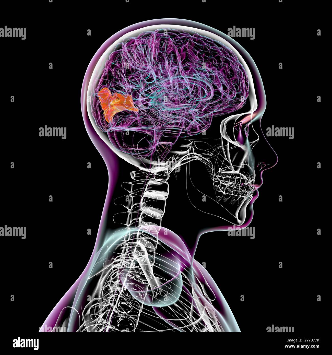 Computer illustration of the human brain highlighting the cuneus gyrus ...