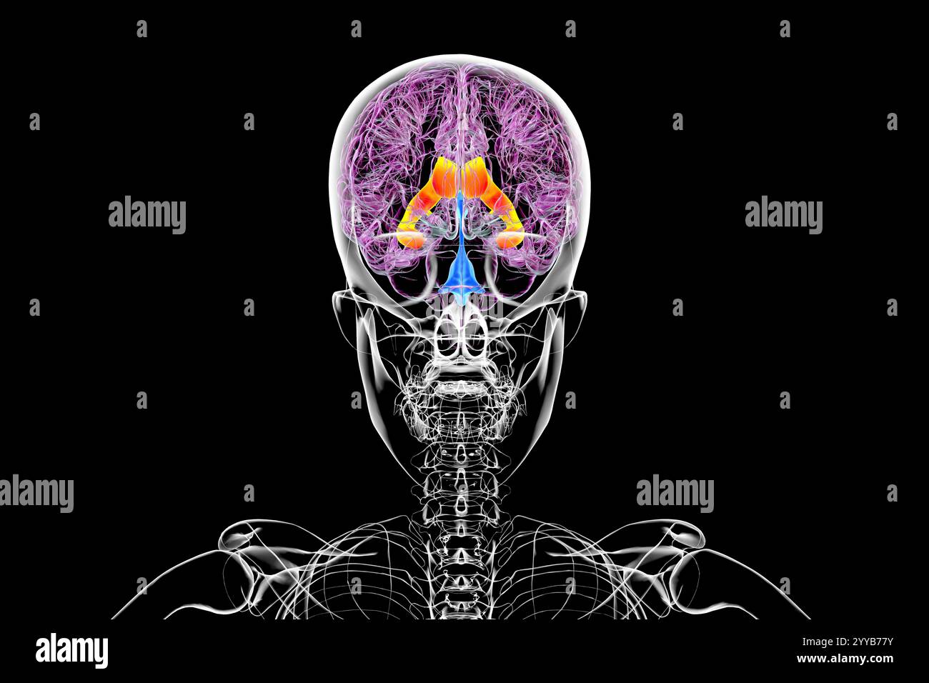 Computer illustration of the lateral brain ventricles, the largest ...