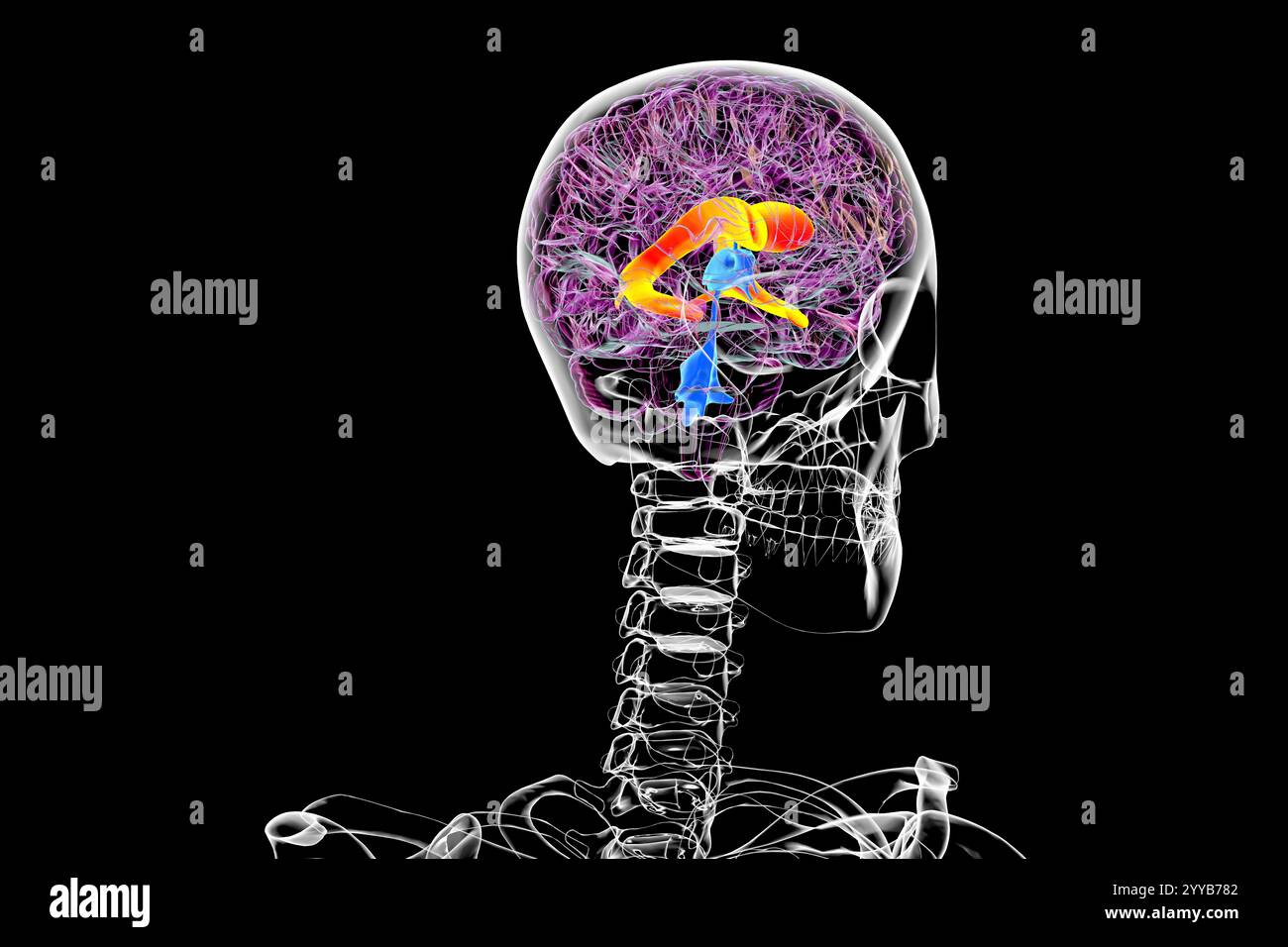 Computer illustration of the lateral brain ventricles, the largest ...