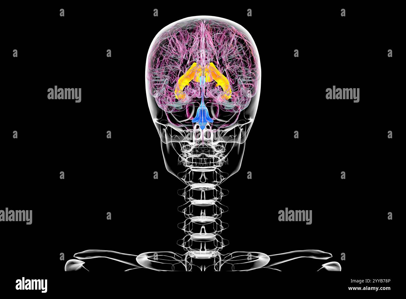 Computer illustration of the lateral brain ventricles, the largest ...