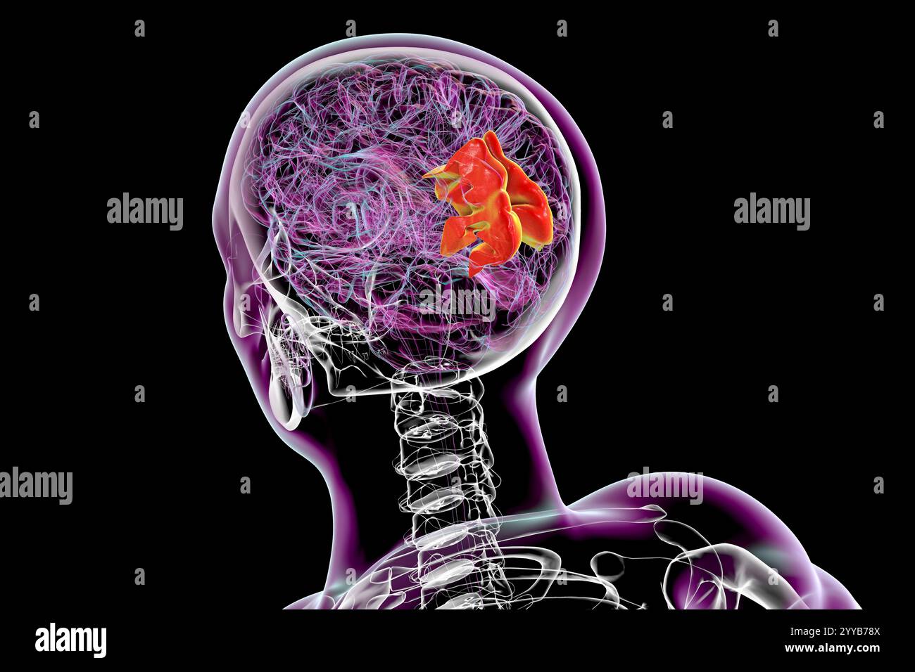 Computer illustration of a human brain with the precuneus gyrus ...