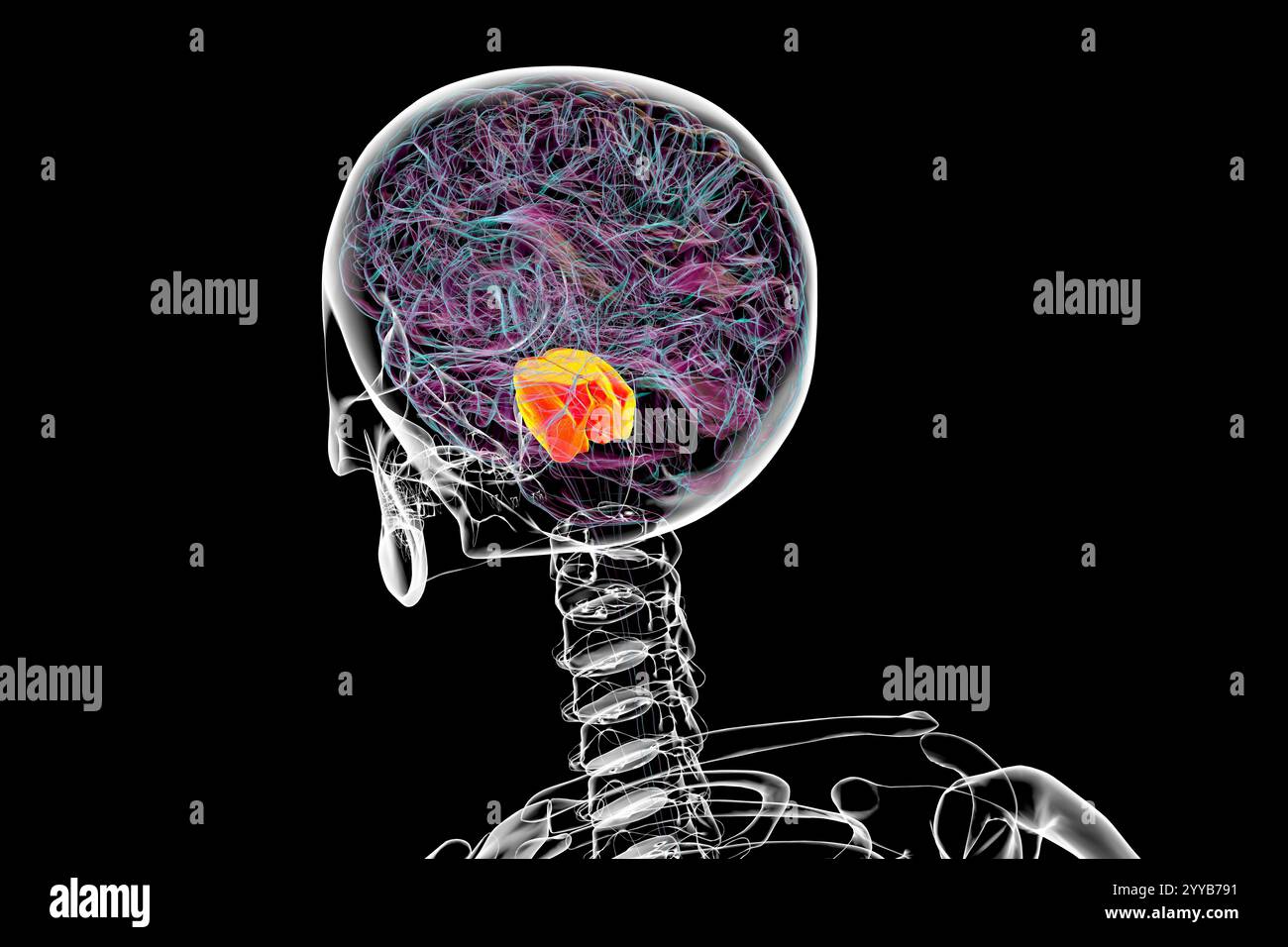 Computer illustration of the brain with the pons highlighted in orange ...