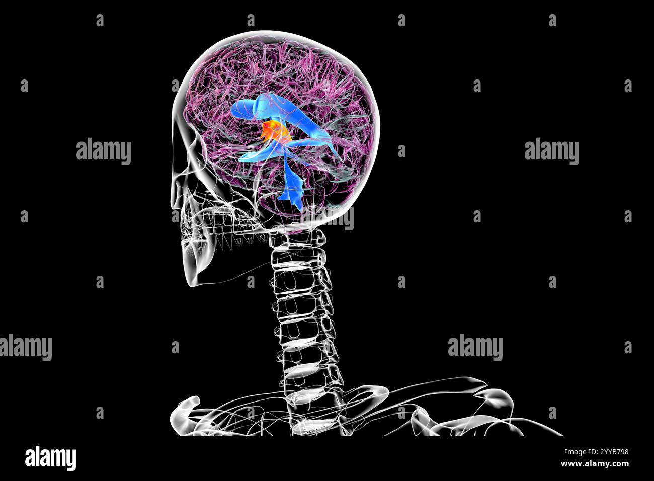 Computer illustration of the third brain ventricle, a vital component ...