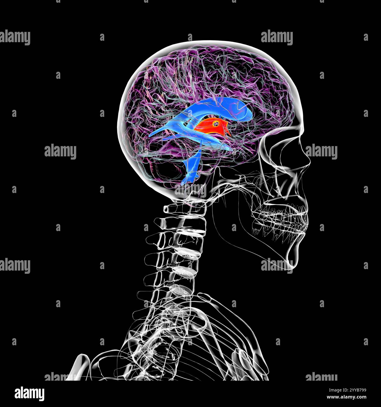 Computer illustration of the third brain ventricle, a vital component of the brain's ventricular ...