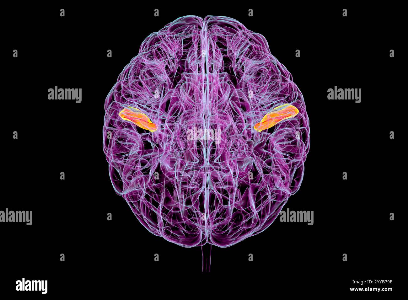 Computer illustration of a human brain with the transverse temporal ...