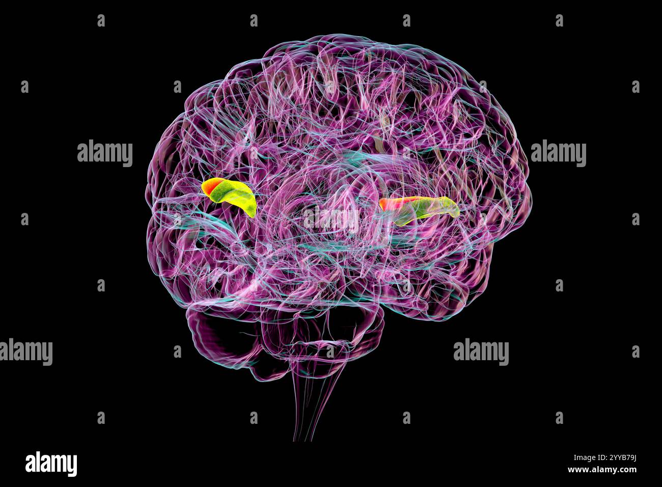 Computer illustration of a human brain with the transverse temporal ...