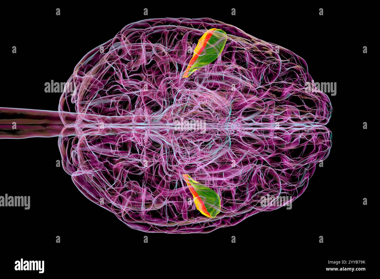 Computer illustration of a human brain with the transverse temporal ...