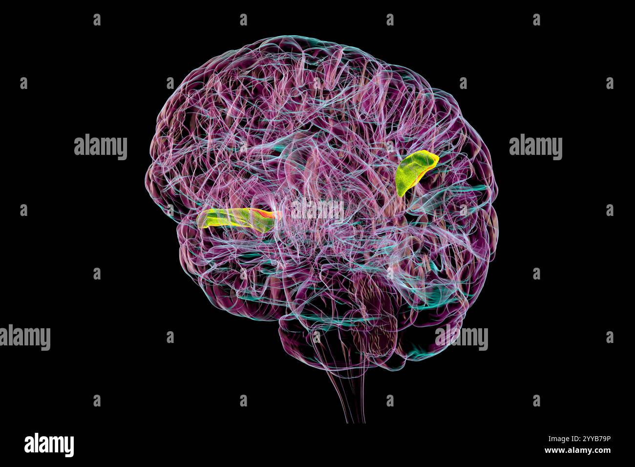 Computer illustration of a human brain with the transverse temporal ...