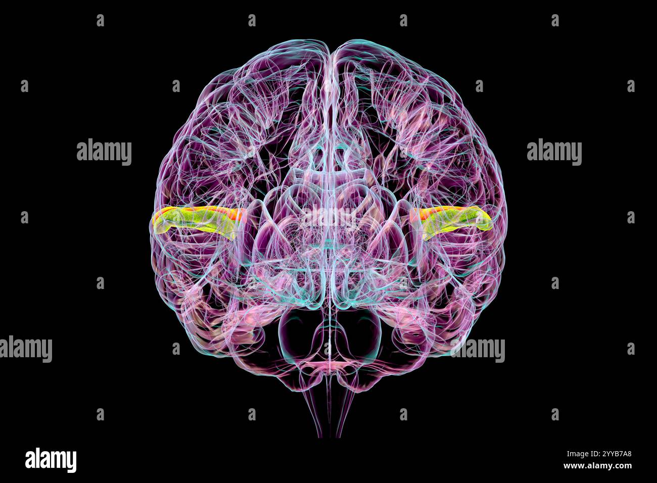 Computer illustration of a human brain with the transverse temporal ...
