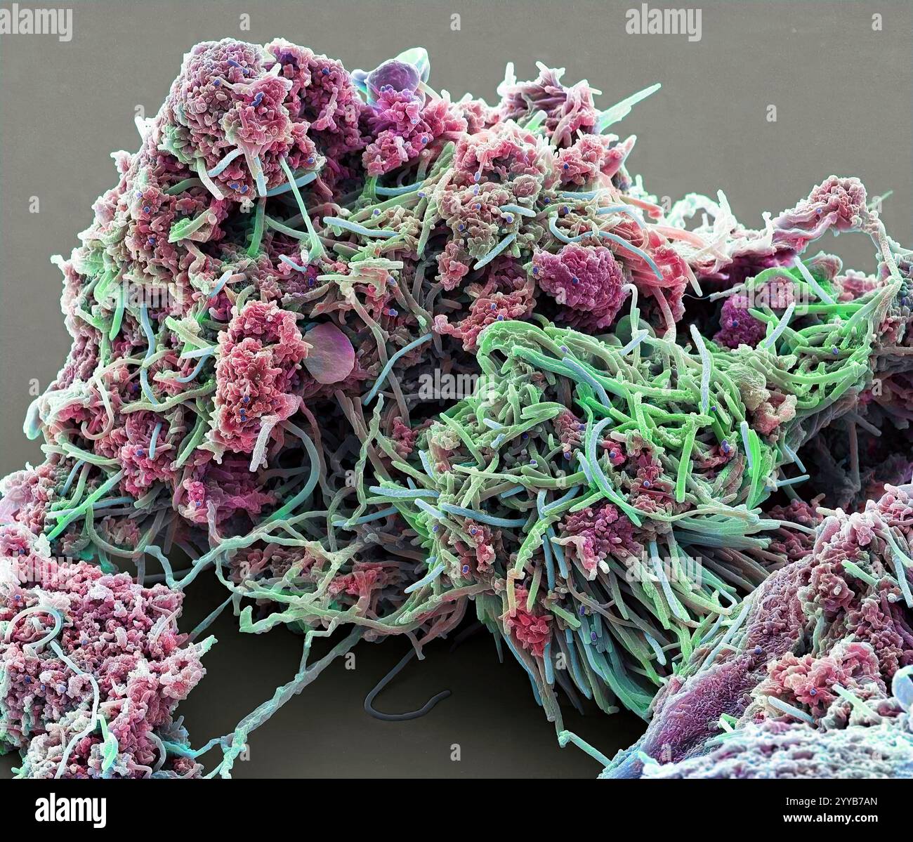 Dental plaque micrograph hi-res stock photography and images - Alamy