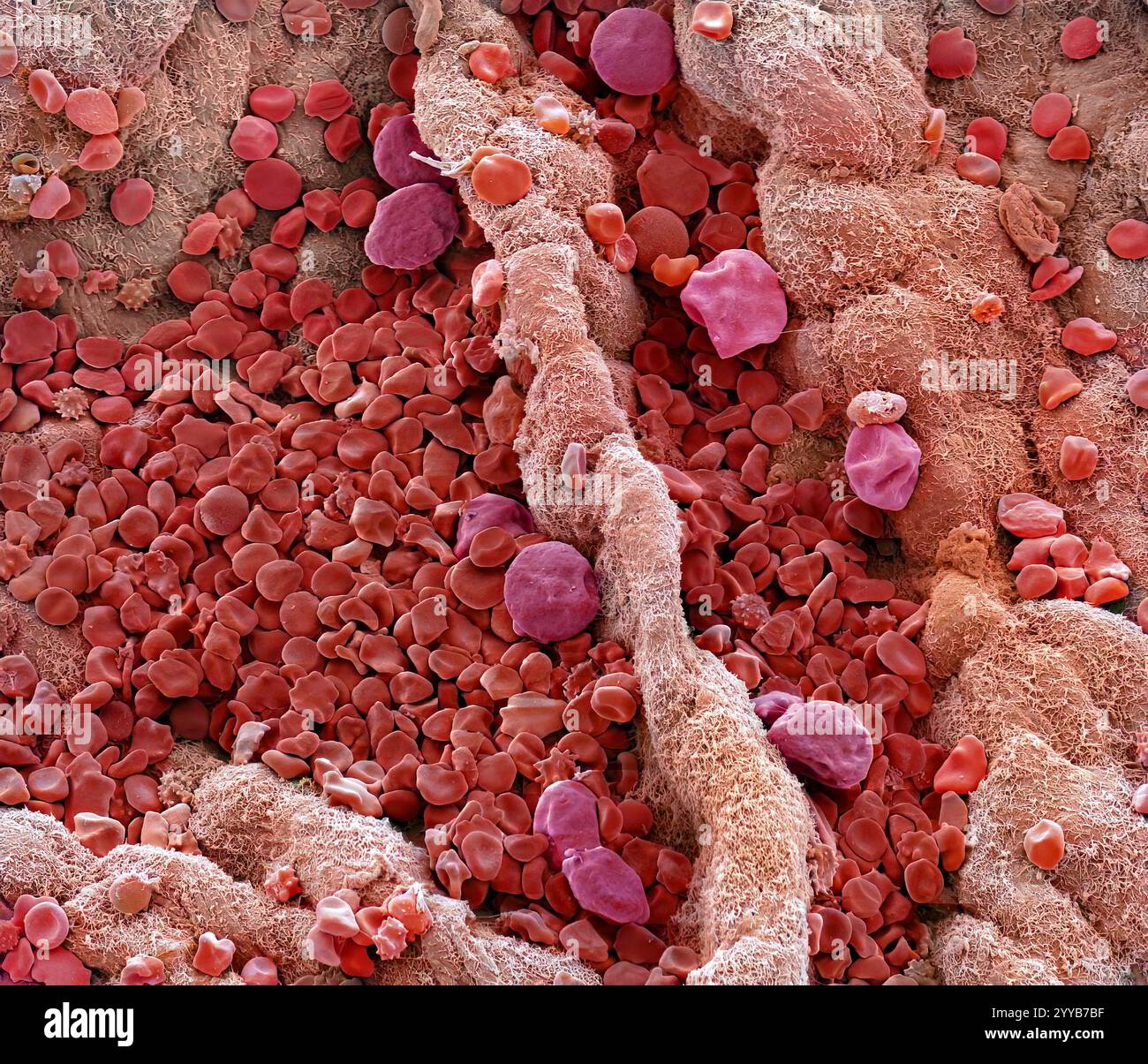 Capillaries sem hi-res stock photography and images - Alamy