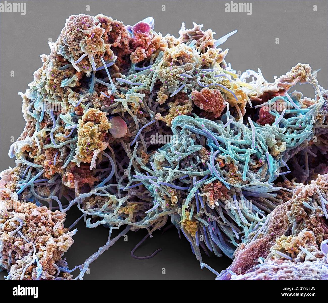 Plaque-forming bacteria, coloured scanning electron micrograph (SEM ...
