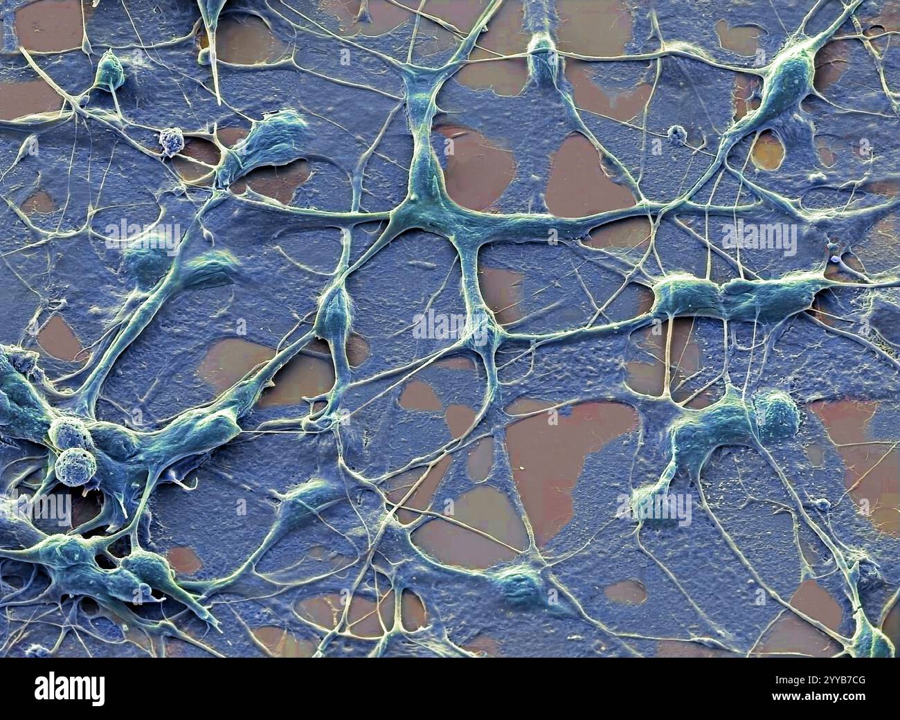 Neurones. Coloured scanning electron micrograph (SEM) of human nerve ...