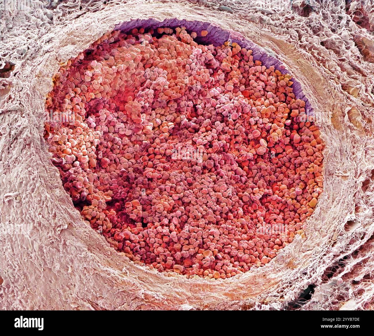 Artery. Coloured scanning electron micrograph (SEM) of a cross-section ...