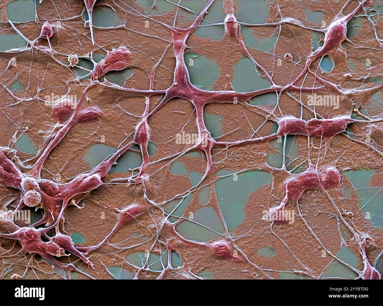 Neurones. Coloured scanning electron micrograph (SEM) of human nerve ...