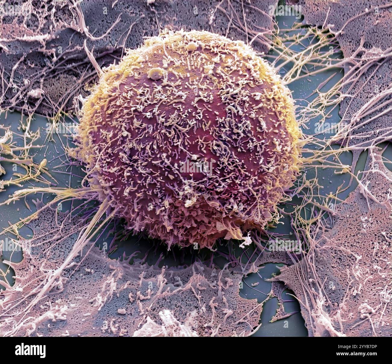HeLa cell. Coloured scanning electron micrograph (SEM) of a HeLa cell ...