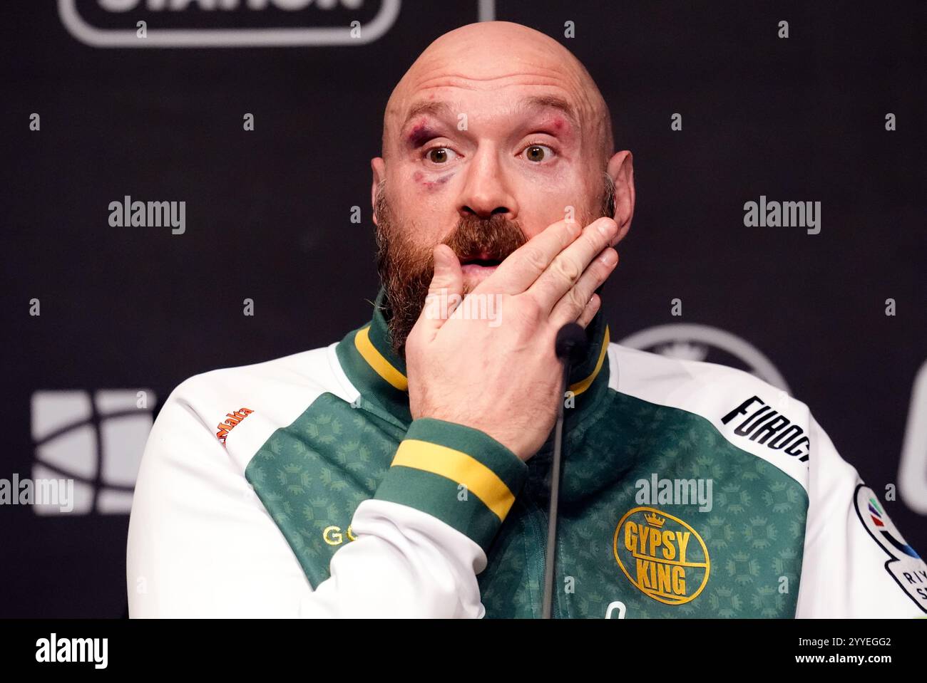 Tyson Fury during a press conference following his defeat to Oleksandr ...