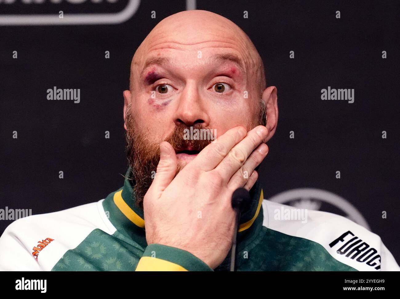 Tyson Fury during a press conference following his defeat to Oleksandr ...