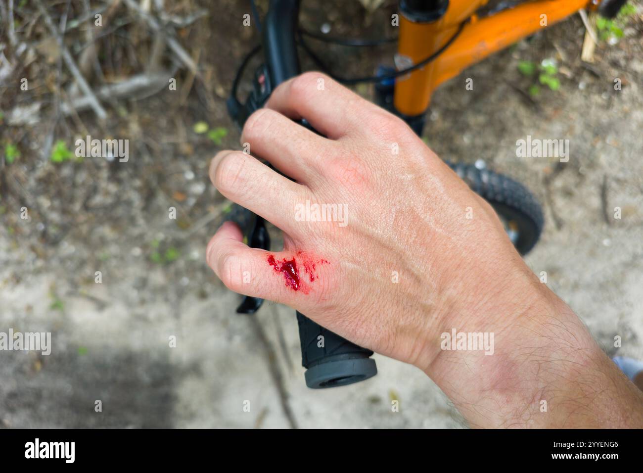 Arm injury while riding mountain bike on Florida jungle trails. Red ...