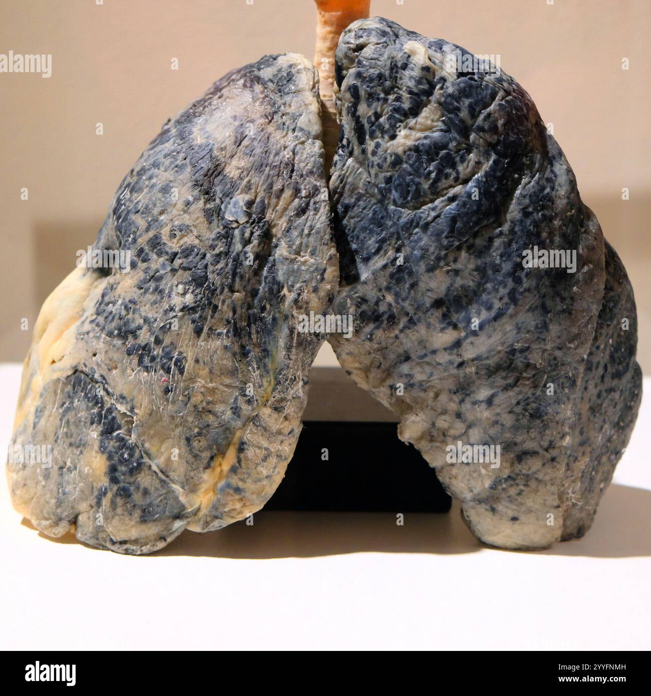 Human lung real hi-res stock photography and images - Alamy