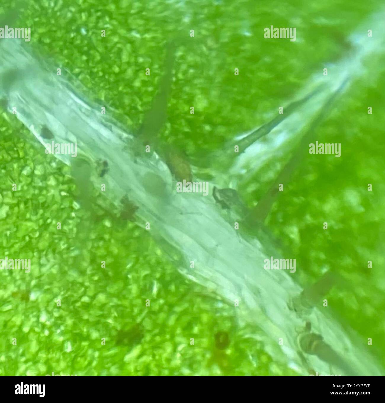 Mites and Ticks (Acari Stock Photo - Alamy