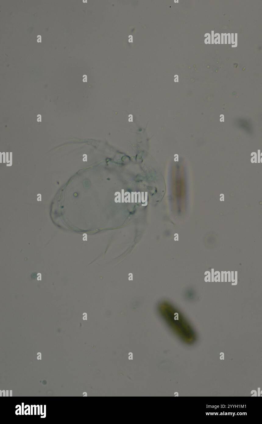 Water Mites (Hydrachnidia Stock Photo - Alamy