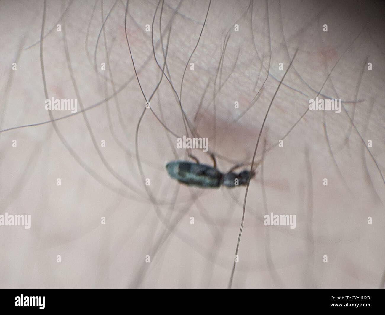 Ant-like Flower Beetles (Anthicidae Stock Photo - Alamy
