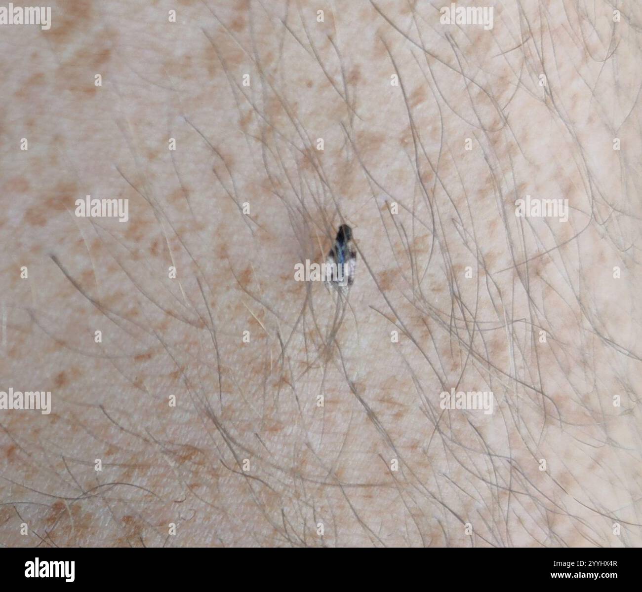 Andromeda Lace Bug (Stephanitis takeyai Stock Photo - Alamy