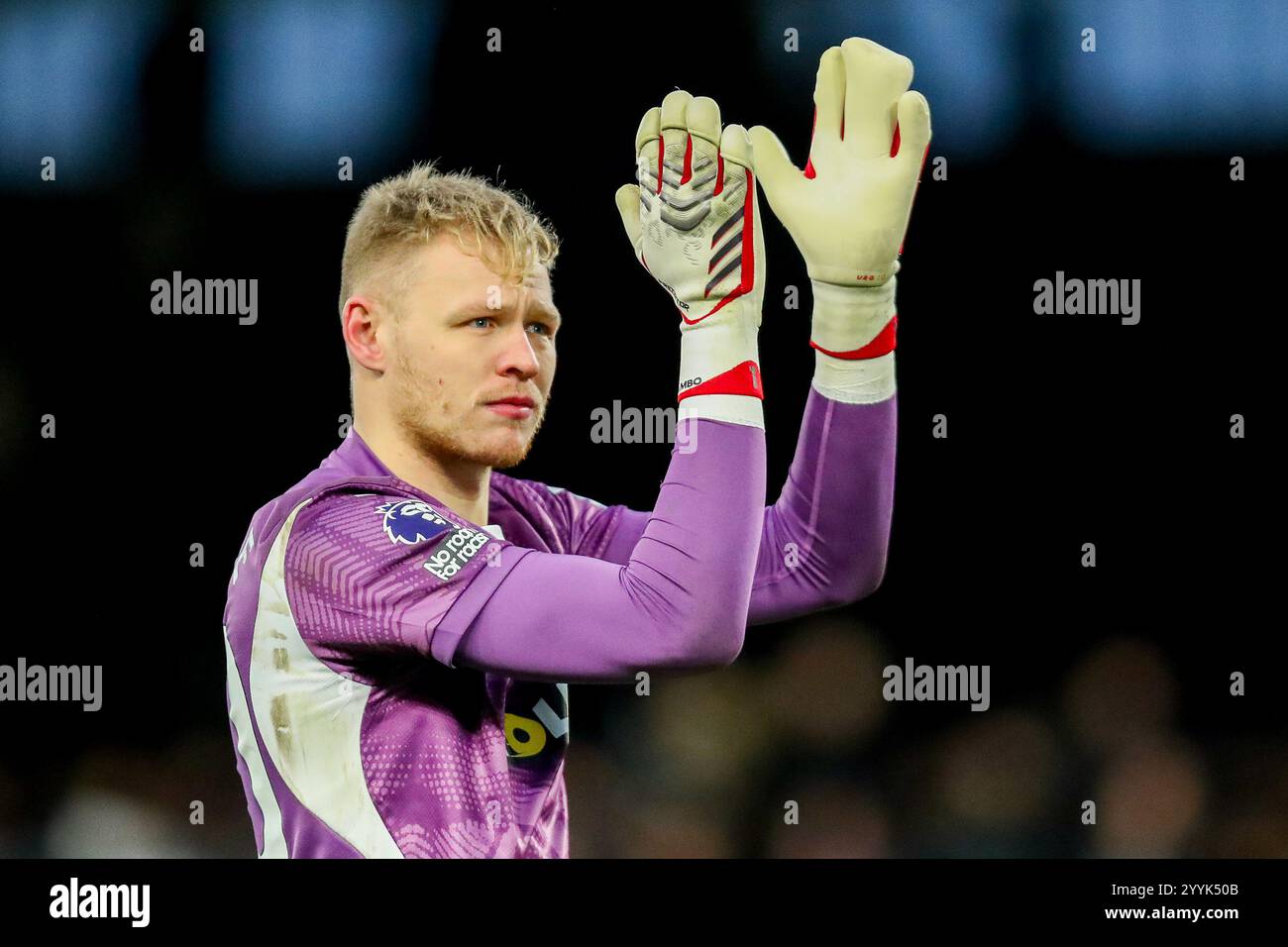 Aaron Ramsdale of Southampton wears a four fingered glove due to a ...