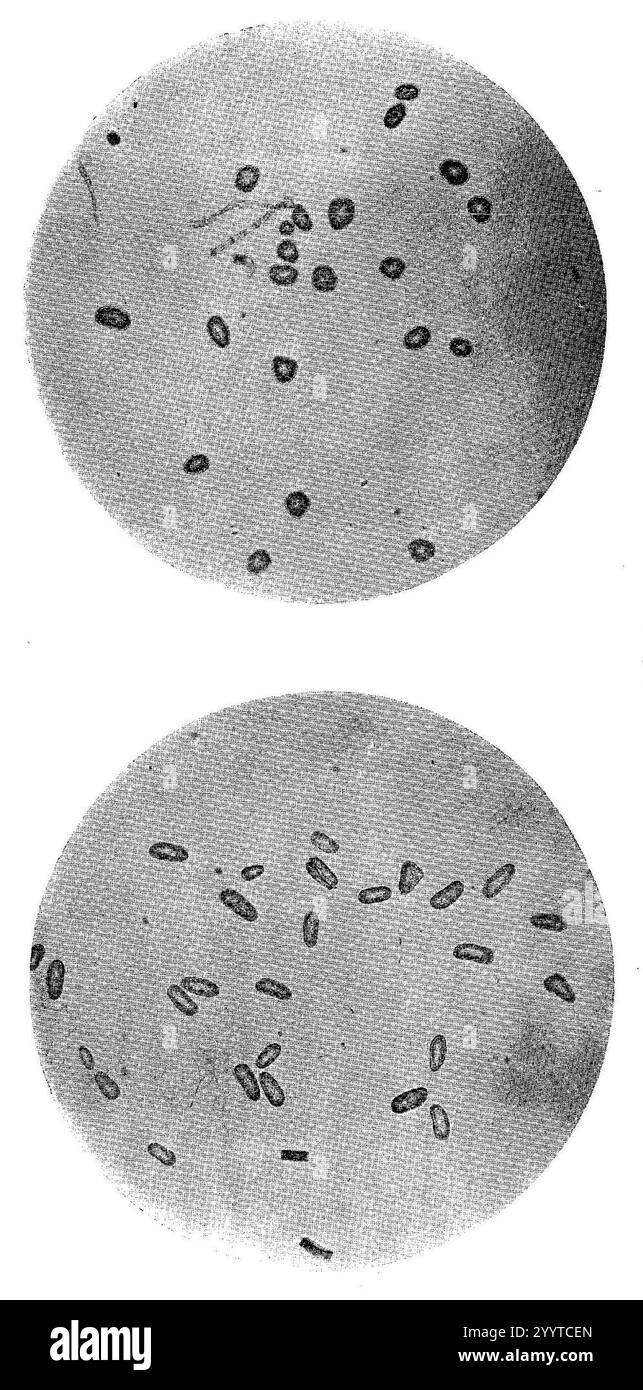 Doorsnede van sluik haar versus kroeshaar Stock Photo - Alamy