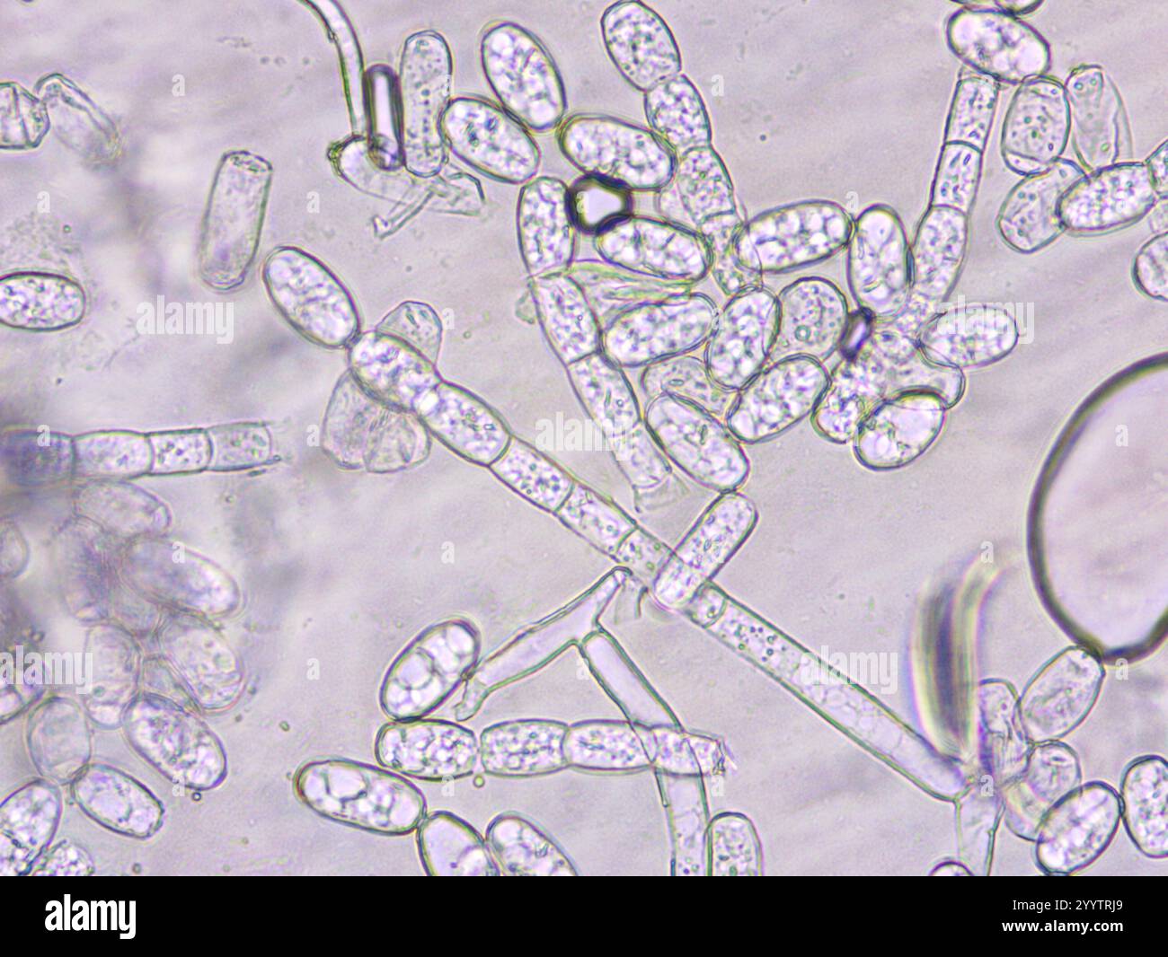 Rose Powdery Mildew (Podosphaera pannosa Stock Photo - Alamy