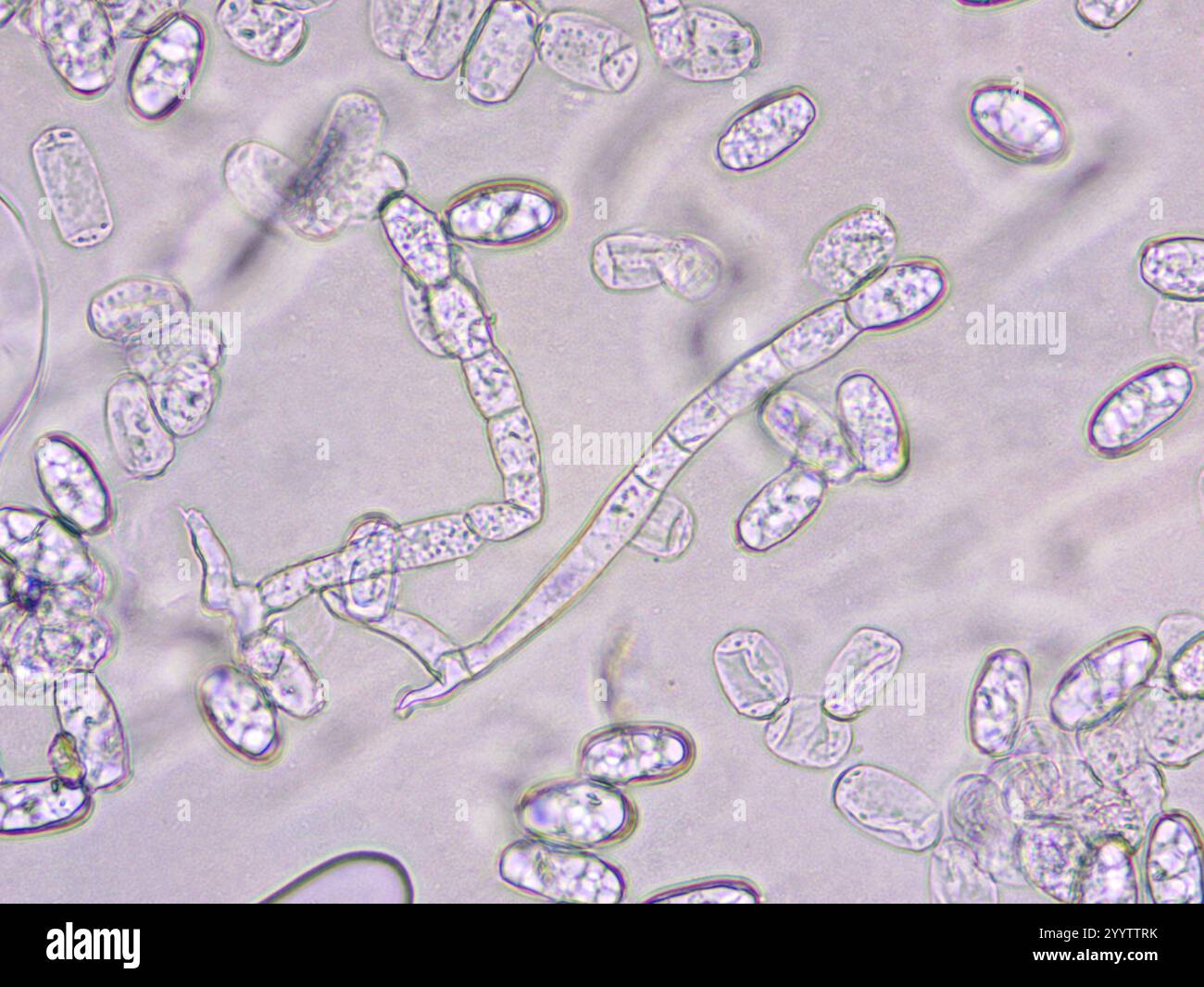 Rose Powdery Mildew (Podosphaera pannosa Stock Photo - Alamy