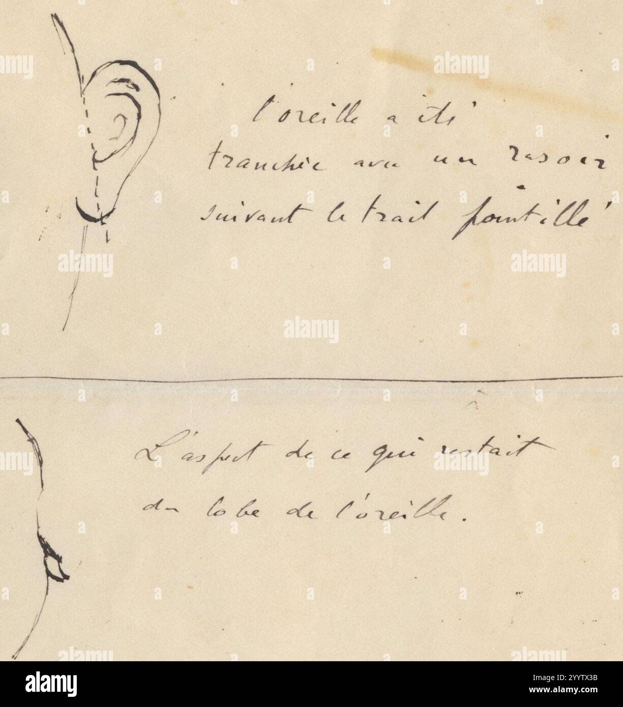 Drawing of the mutilation of Vincent van Gogh's ear (cropped Stock ...