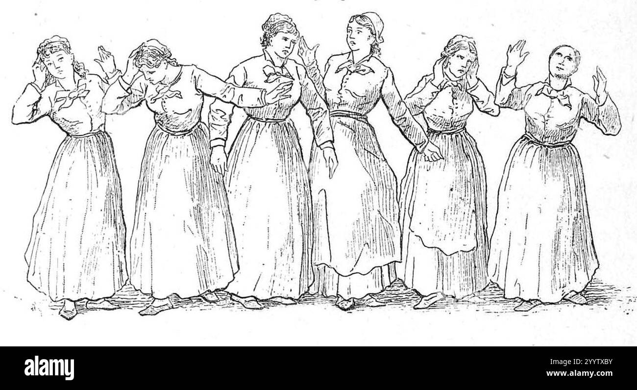 Drawings of a woman in catalepsy by Albert Londe Stock Photo - Alamy