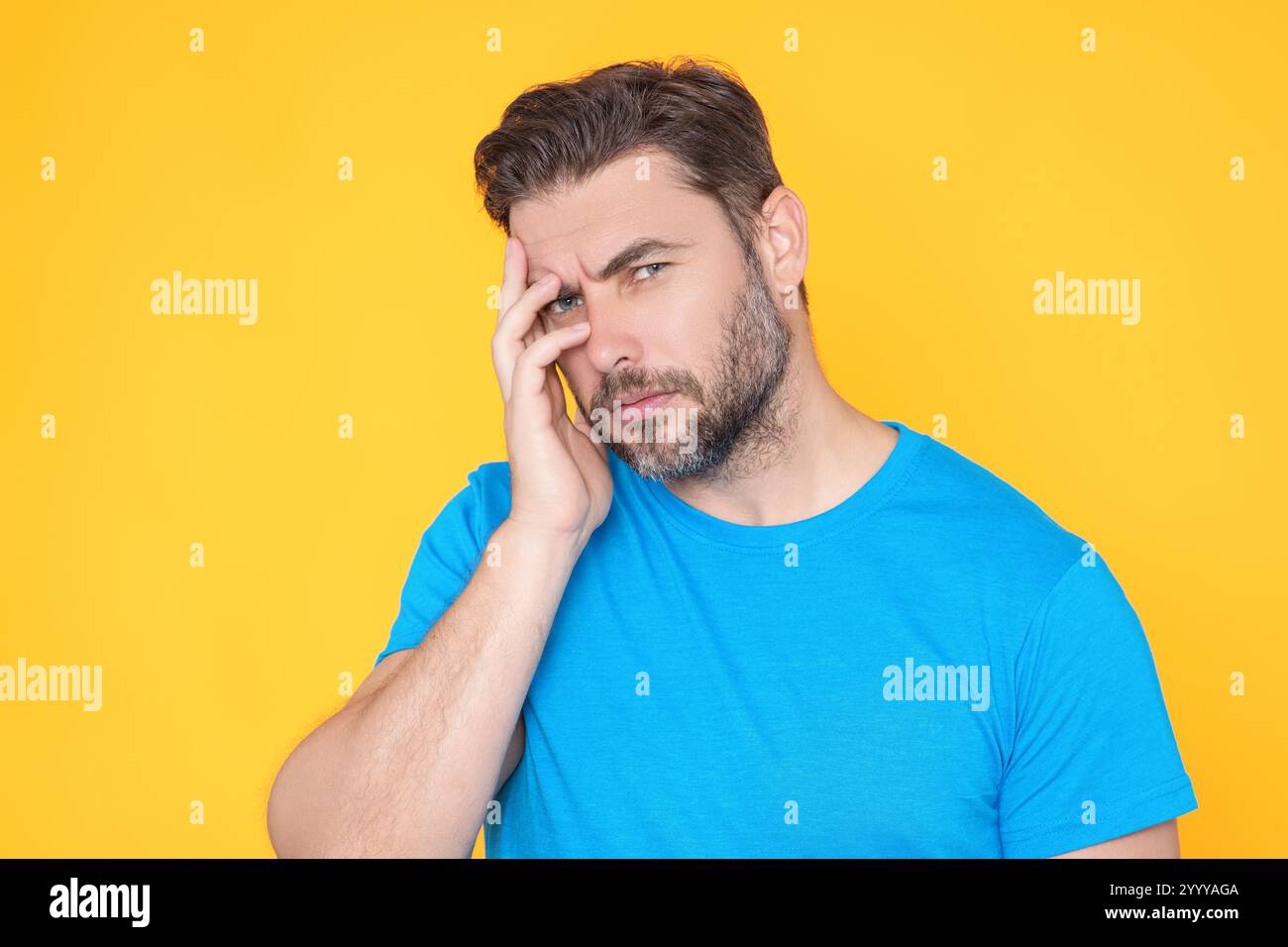 Millennial man having headache. Man in suffer from migraine or headache ...