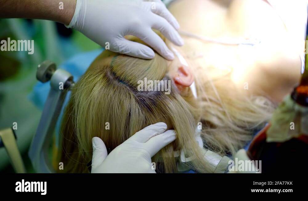 Craniotomy temporal Stock Videos & Footage - HD and 4K Video Clips - Alamy