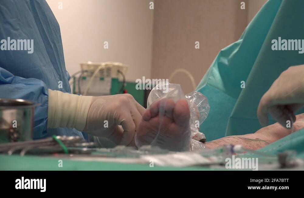 Endovenous laser ablation (EVLA) is a commonly used and very effective ...