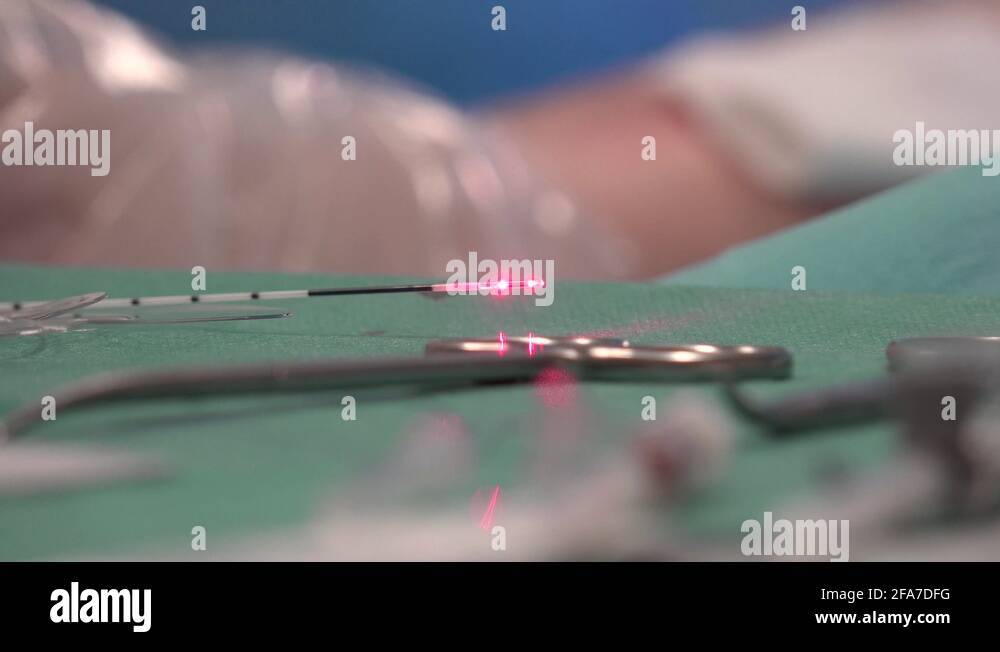 Endovenous laser ablation (EVLA) is a commonly used and very effective ...