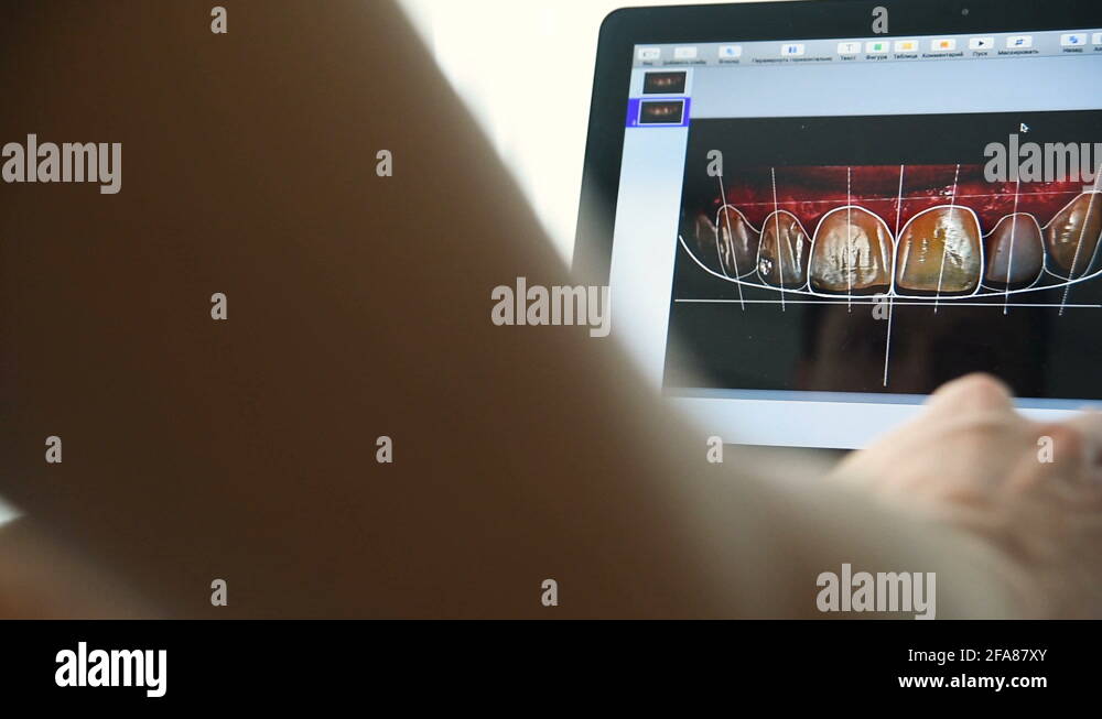 Dentist shows patient snapshot teeth Stock Videos & Footage - HD and 4K Video Clips - Alamy