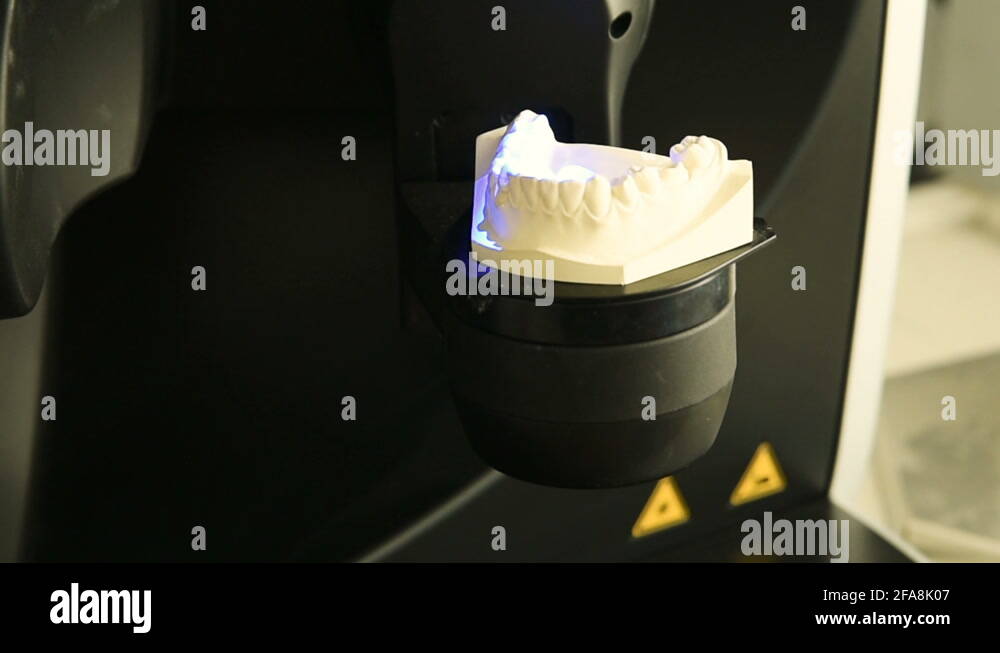 Denture alignment Stock Videos & Footage - HD and 4K Video Clips - Alamy